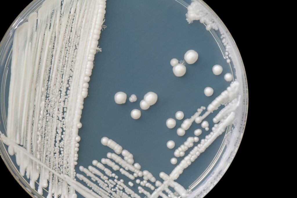 Candida Yeast Natural Recovery | Active Edge Chiropractic & Functional ...